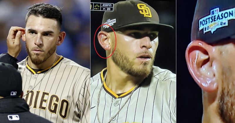 Padres Star Joe Musgrove’s Mystery Substance Identified (Photos) - Game 7